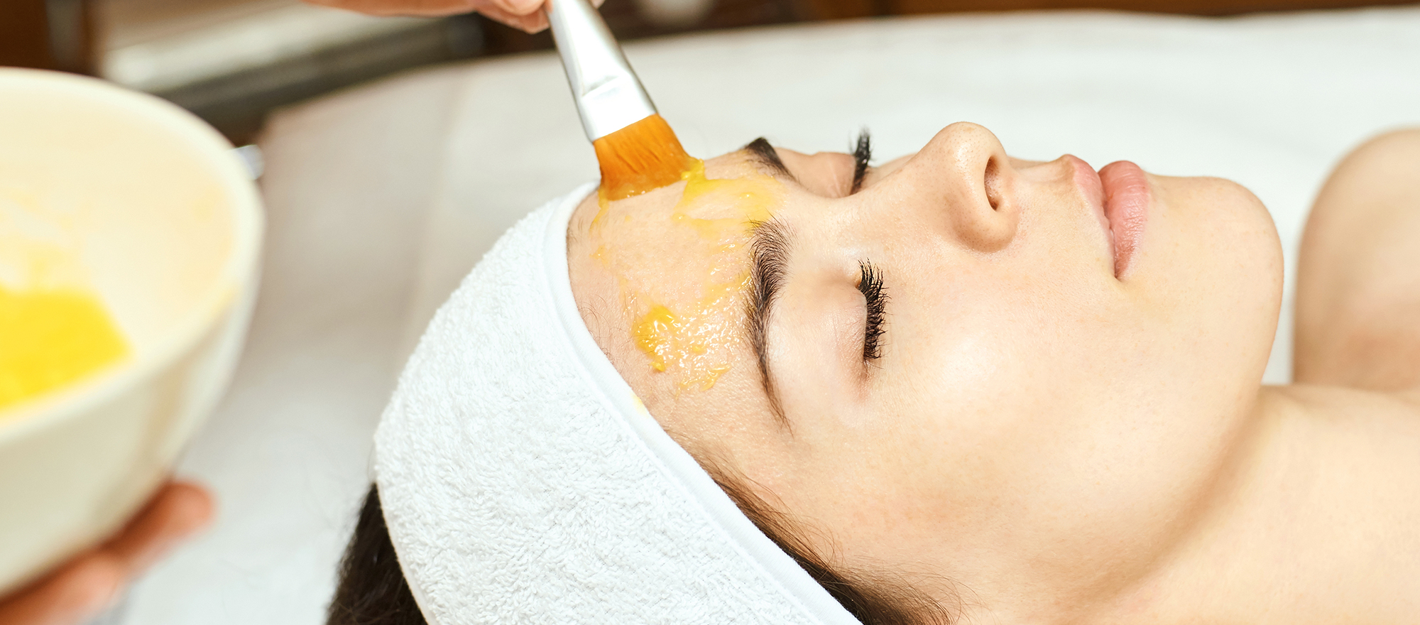 Everything you Need to Know about Chemical Peels - Innovative MedSpa
